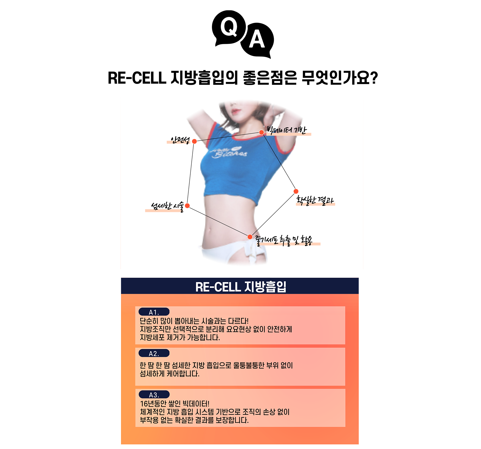 SC301 SVF 지방흡입