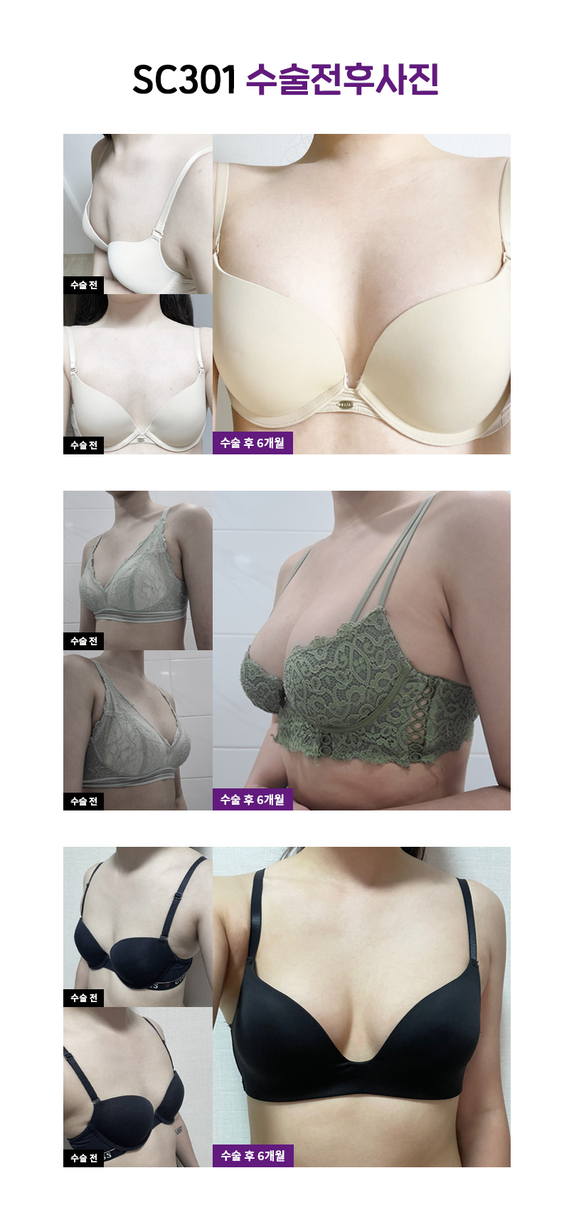 sc301 전화상담